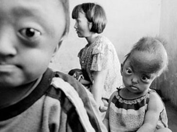 Horrific Science Experiments Ever Performed | brainbend